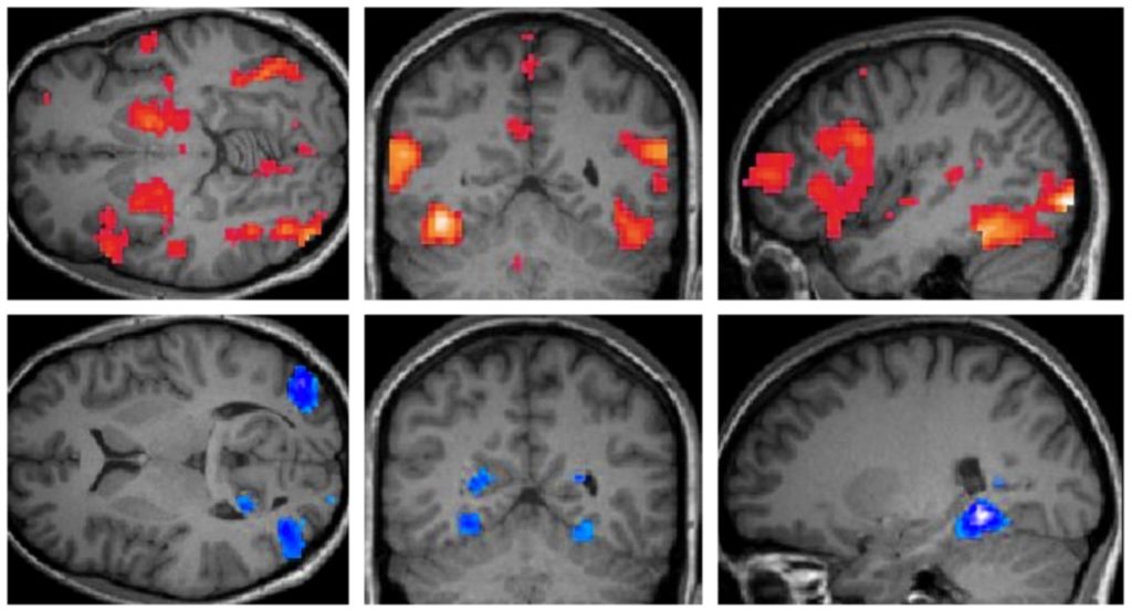 Neuroimaging as a case study in research data management: Part 1 – UC3 ...